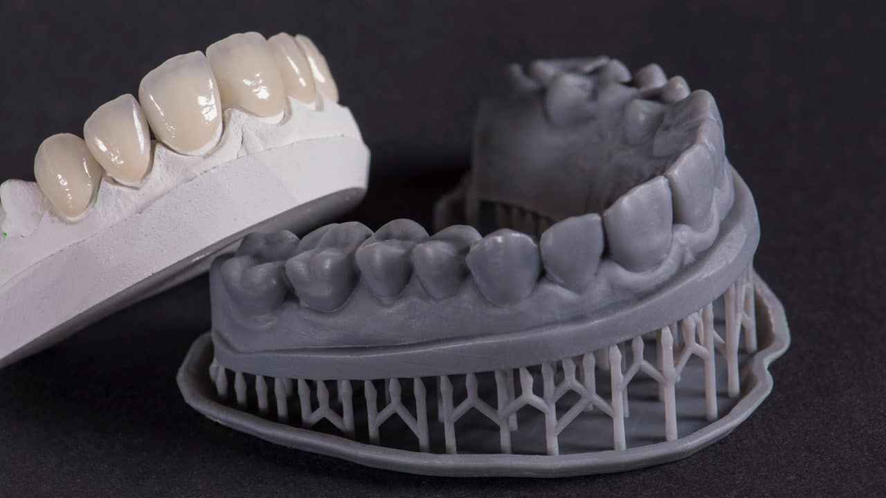 Veneers in der Türkei - Fly2Smile